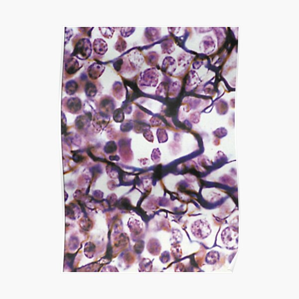 Connective Tissue Posters | Redbubble