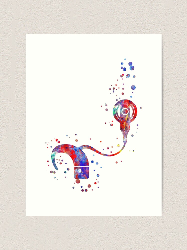 "Cochlear implant" Art Print for Sale by Rosaliartbook | Redbubble