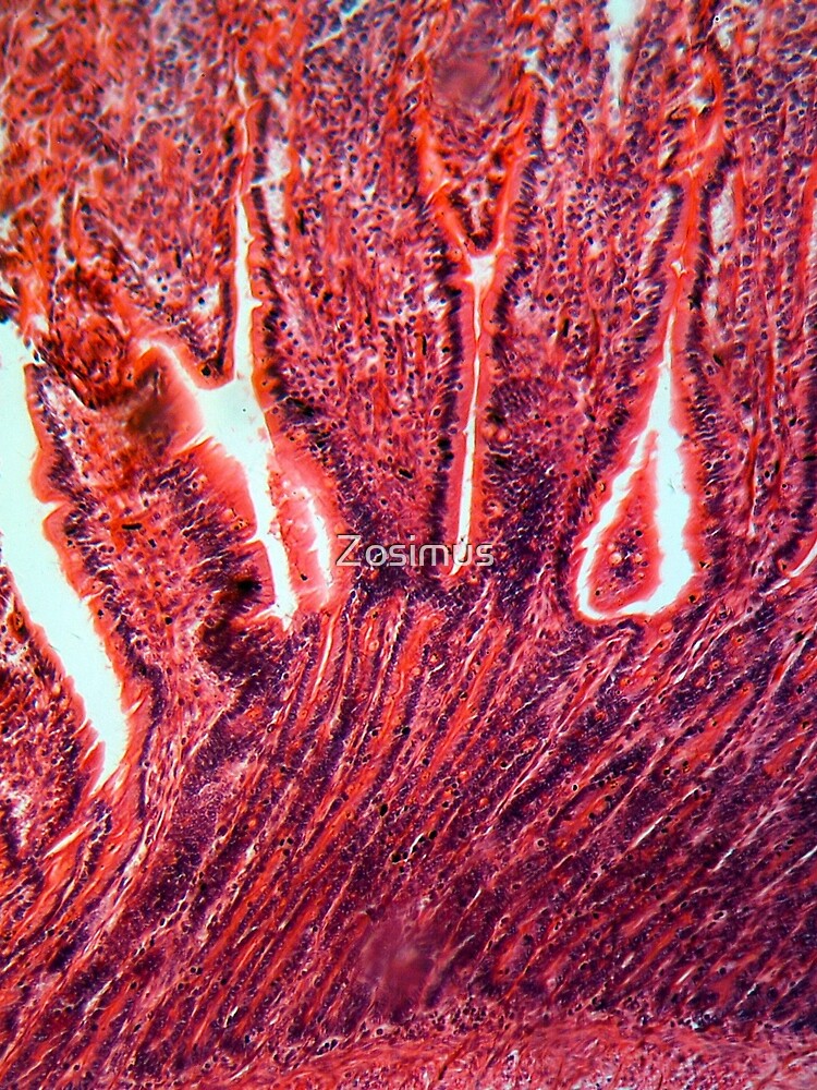 "A section trough cells of a small intestine under the microscope ...