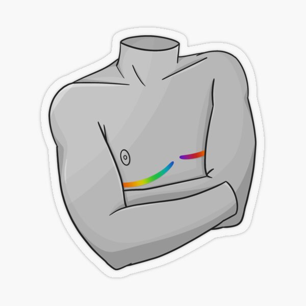 Top Surgery Stickers | Redbubble