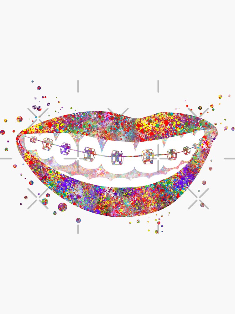 "Teeth braces, dental anatomy" Sticker for Sale by Rosaliartbook ...