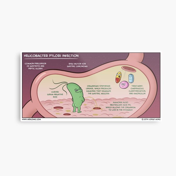 "Helicobacter Pylori Infection" Metal Print for Sale by Medcomic ...