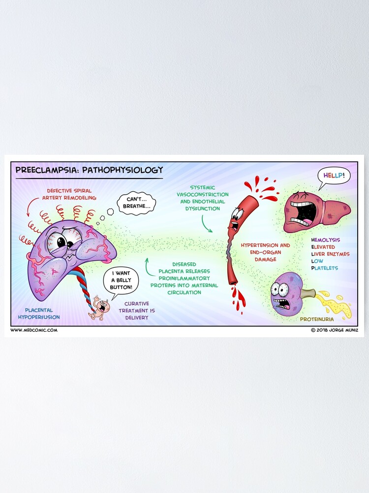 "Preeclampsia: Pathophysiology" Poster for Sale by Medcomic | Redbubble