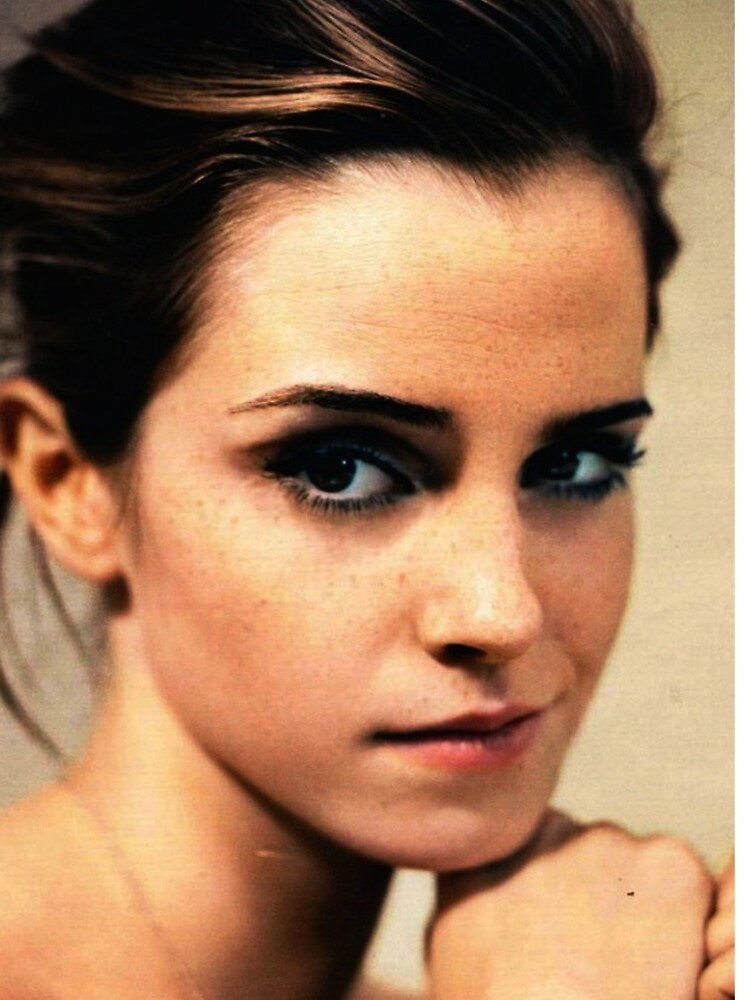 "Emma Watson" iPhone Case for Sale by Dorium | Redbubble