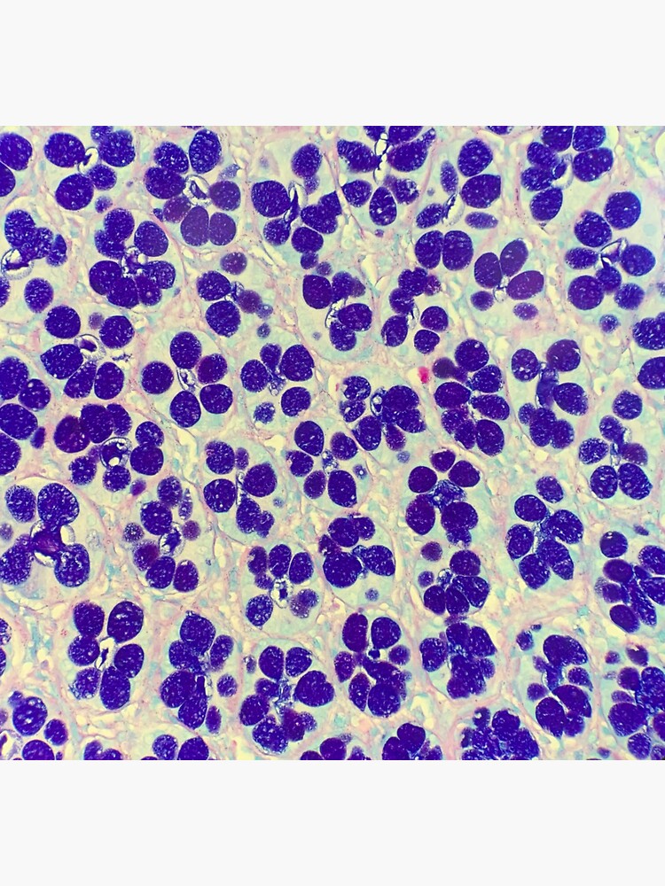 "Histologie Colon AB / PAS-Färbung" Sticker von HistoQueen | Redbubble