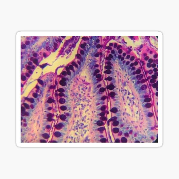 "Histology Small Intestine" Sticker for Sale by HistoQueen | Redbubble