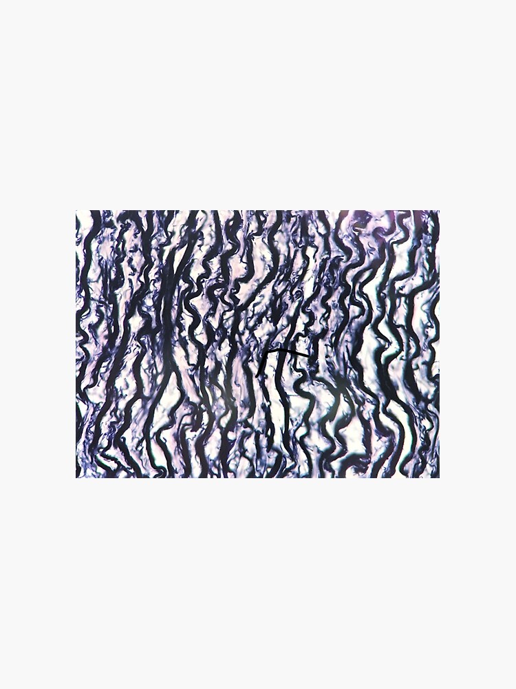 "Histology Artery VVG Stain" Sticker for Sale by HistoQueen | Redbubble