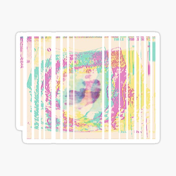 Ultrasound Stickers | Redbubble