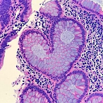 "Histology Heart Colon" Sticker for Sale by HistoQueen | Redbubble