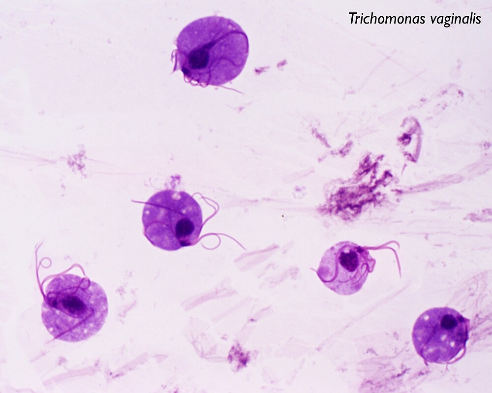 «tricomonas vaginalis» de Bobbi Pritt | Redbubble