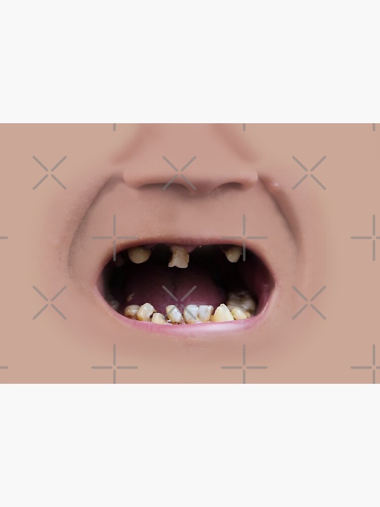 "Hill BIlly Bubba Teeth Photo Realistic Men's " Mask for Sale by ...