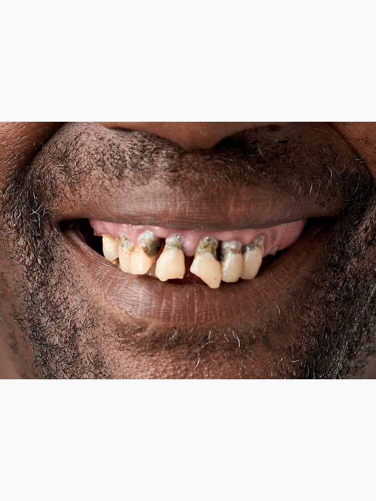 "Fake Bad Teeth Smile Personal Protection Corona Virus Mask" Mask for ...