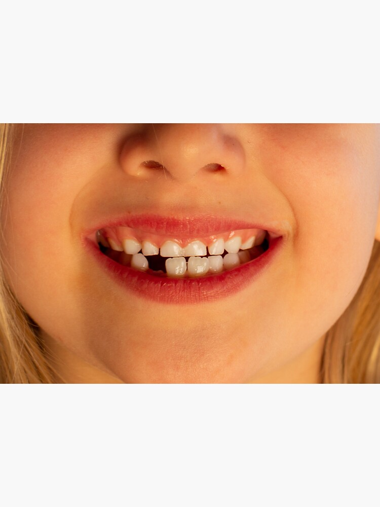 "Smile! Super cute and really funny kid smile missing 1 tooth" Sticker ...