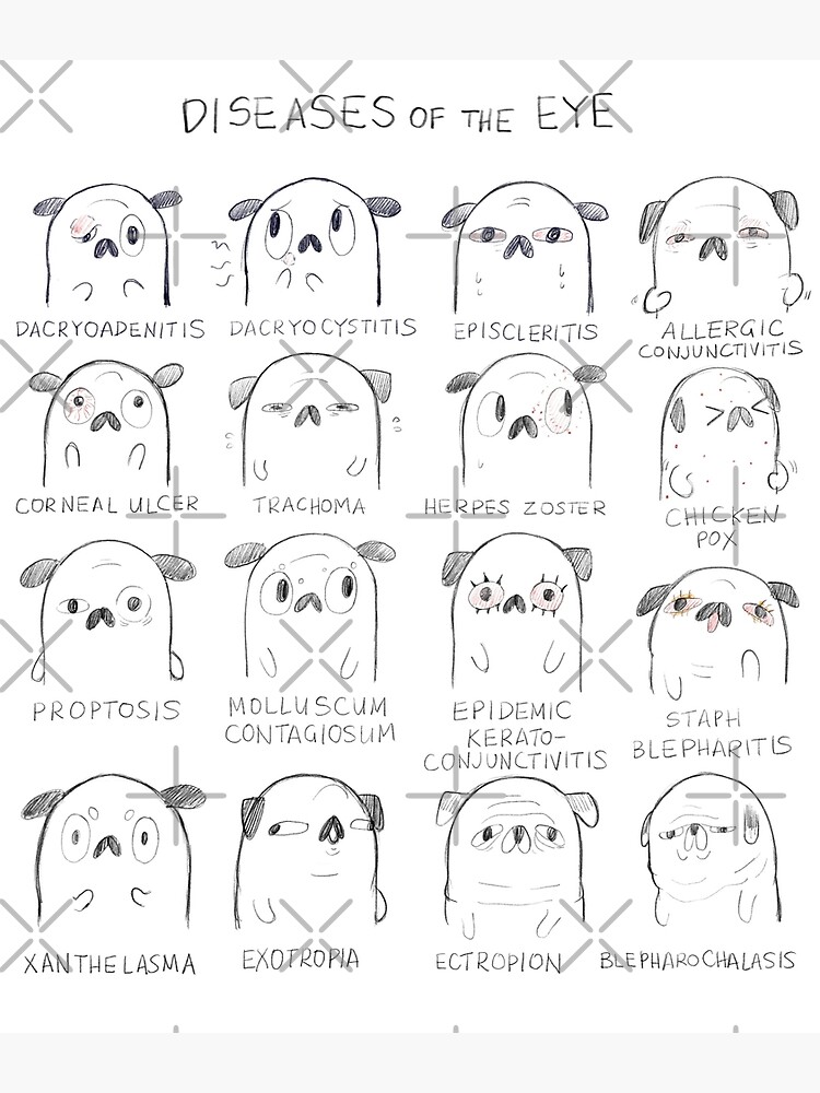 "Pug Ocular Disease" Art Print by pugopolis | Redbubble