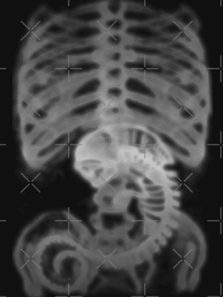 "Alien radiography , Alien X-ray" T-shirt for Sale by camikaze-es ...