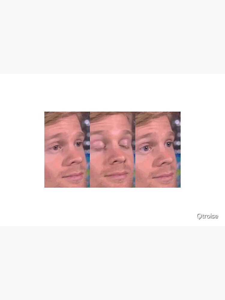 Blinking Meme Petition To Make This The New “white Guy Blinking”