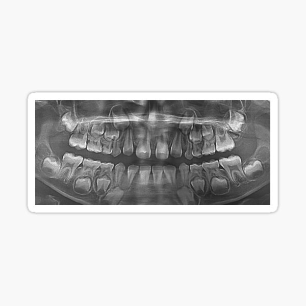 "Creepy Smile" Sticker for Sale by majones76 | Redbubble