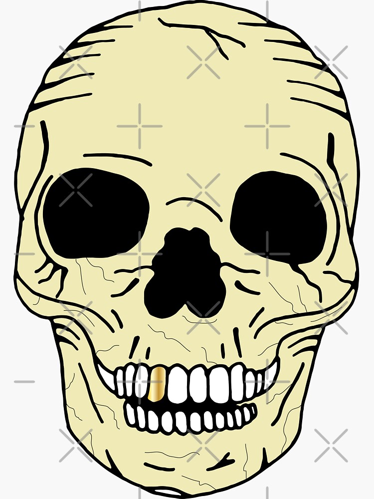 "Cracked Skeleton Skull with Gold Tooth" Sticker for Sale by ...