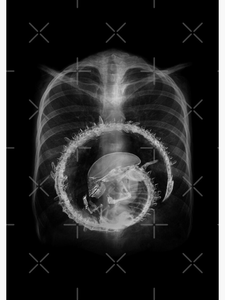 "Alien radiography, Alien X-ray" Spiral Notebook for Sale by camikaze ...