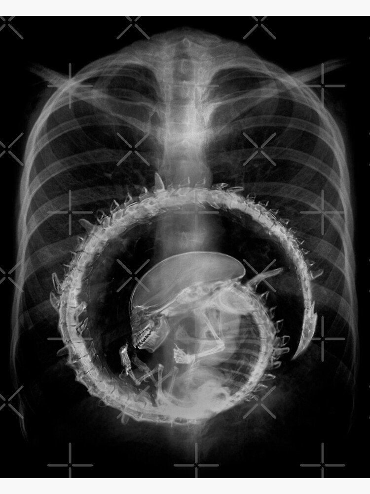 "Alien radiography, Alien X-ray" Photographic Print for Sale by ...