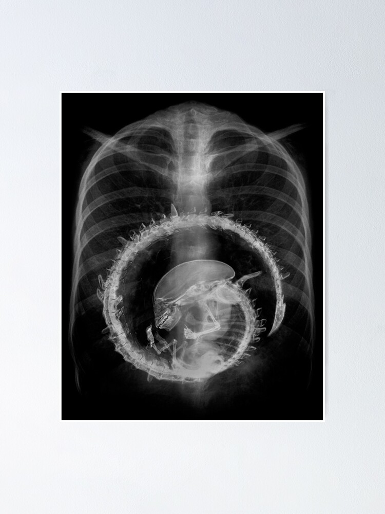 "Alien radiography, Alien X-ray" Poster for Sale by camikaze-es | Redbubble