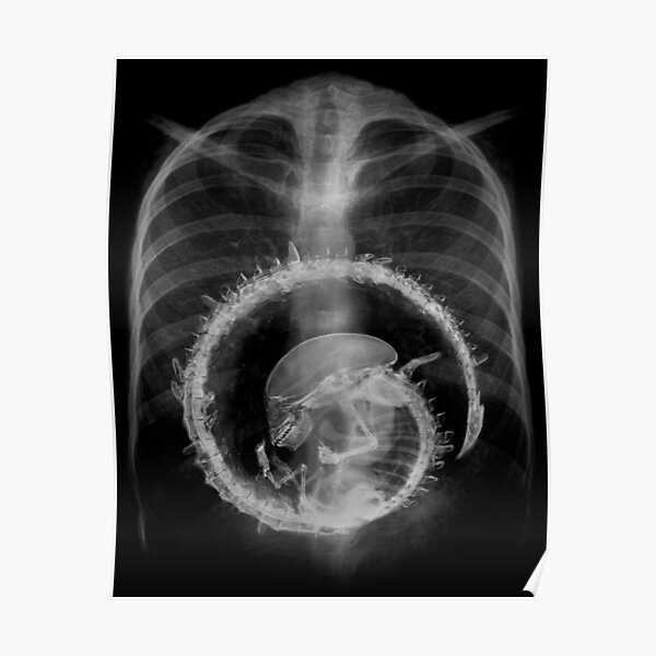 "Alien radiography, Alien X-ray" Poster for Sale by camikaze-es | Redbubble