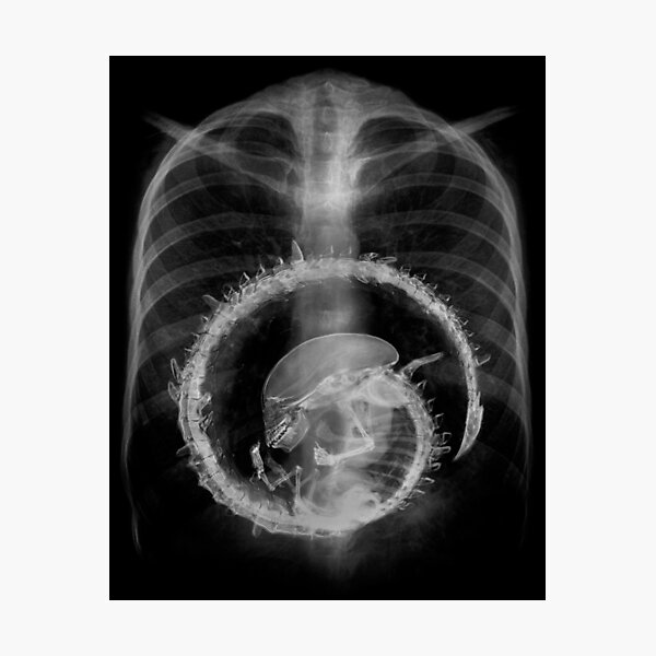 "Alien radiography, Alien X-ray" Photographic Print for Sale by ...