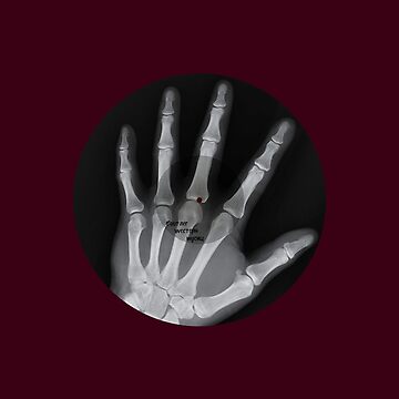 "Bone Music Xray Vinyl" Art Board Print for Sale by eldram | Redbubble