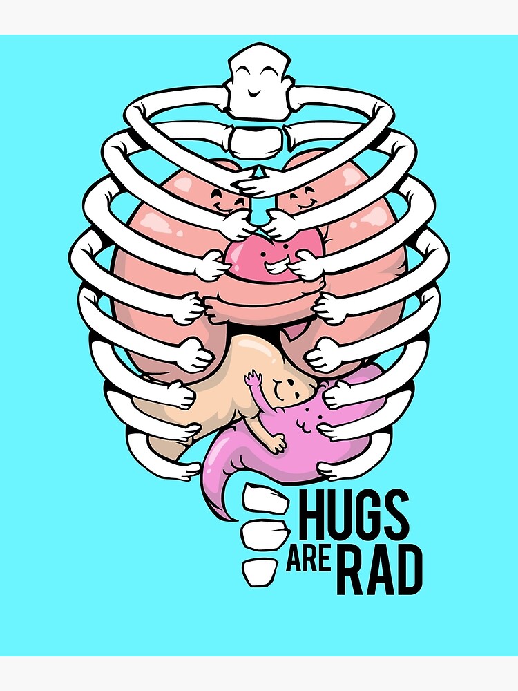 "Hugs Are Rad - Radiology X-Ray Tech Appreciation Hugging Skeleton ...