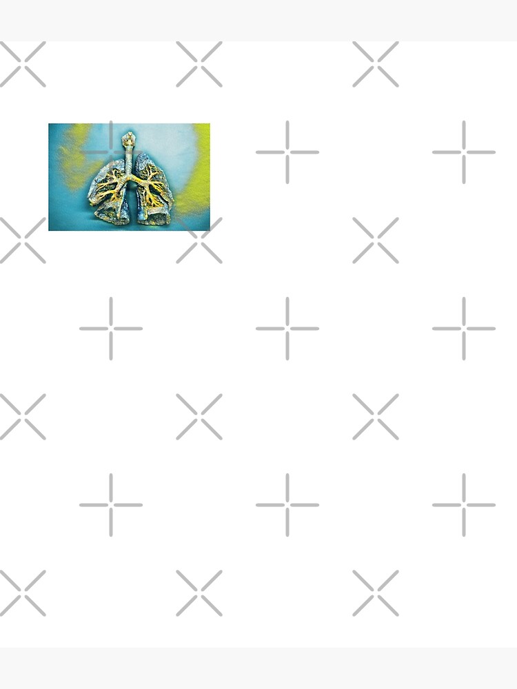 Human Lung - Blue And Yellow. Backpack