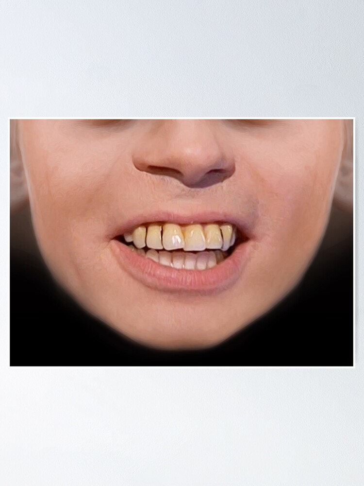 "Bad teeth Smile Face mask." Poster for Sale by mavisshelton | Redbubble