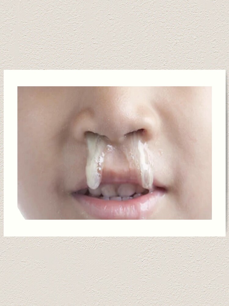 "Funny Face Gross Snot Nose Kid Mucus Flowing From Nose Of Young Boy ...