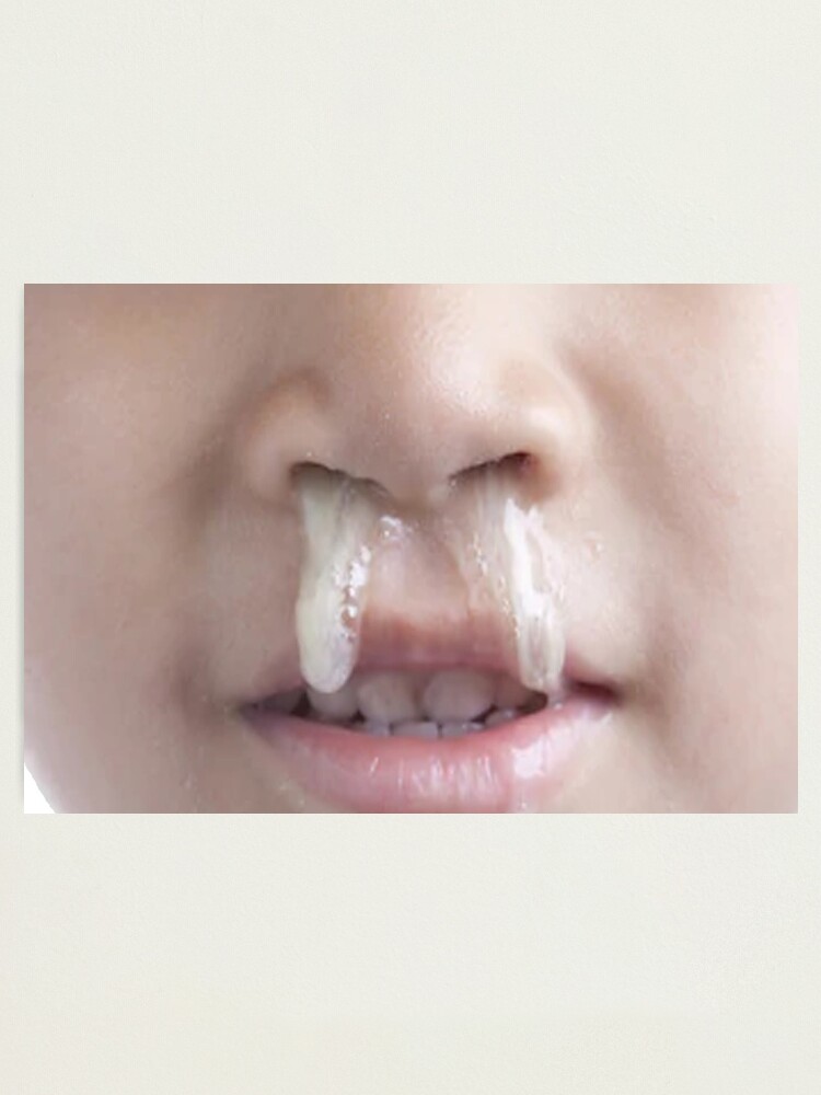 "Funny Face Gross Snot Nose Kid Mucus Flowing From Nose Of Young Boy ...
