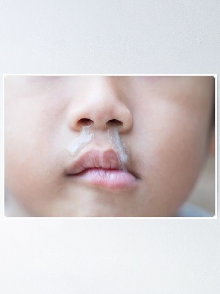 Snotty nose store