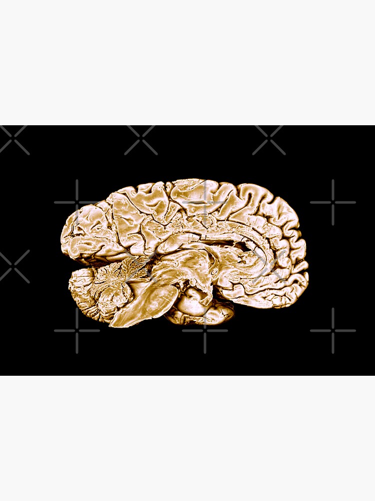 "Human Brain - Gold - Classic Black Background" Sticker for Sale by ...