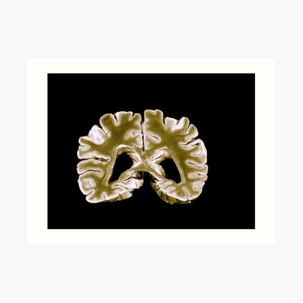 "Design of Cerebral Cortex - Gold - Classic Black Background" Art Print ...