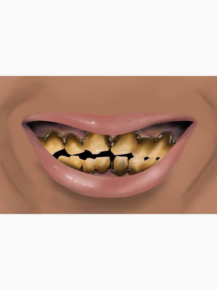 "Rotten teeth smile" Sticker for Sale by alyssascribbles | Redbubble