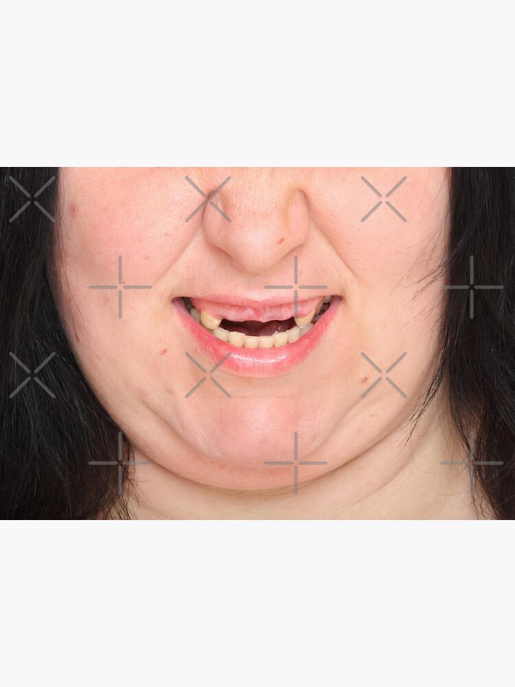 "No Teeth Very Funny face" Sticker for Sale by HarshalPardeshi | Redbubble