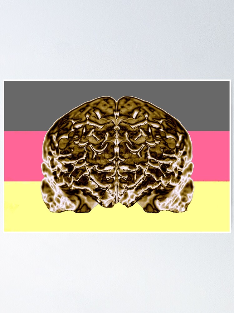 "Human Brain - Gold - Germany Flag Background" Poster by uberanatomy ...