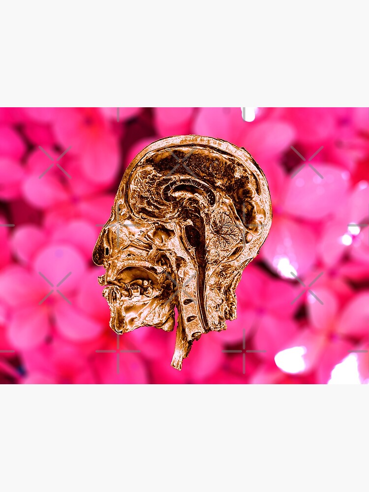 "Human Brain - Rose Gold - Deep Floral Background" Poster for Sale by ...