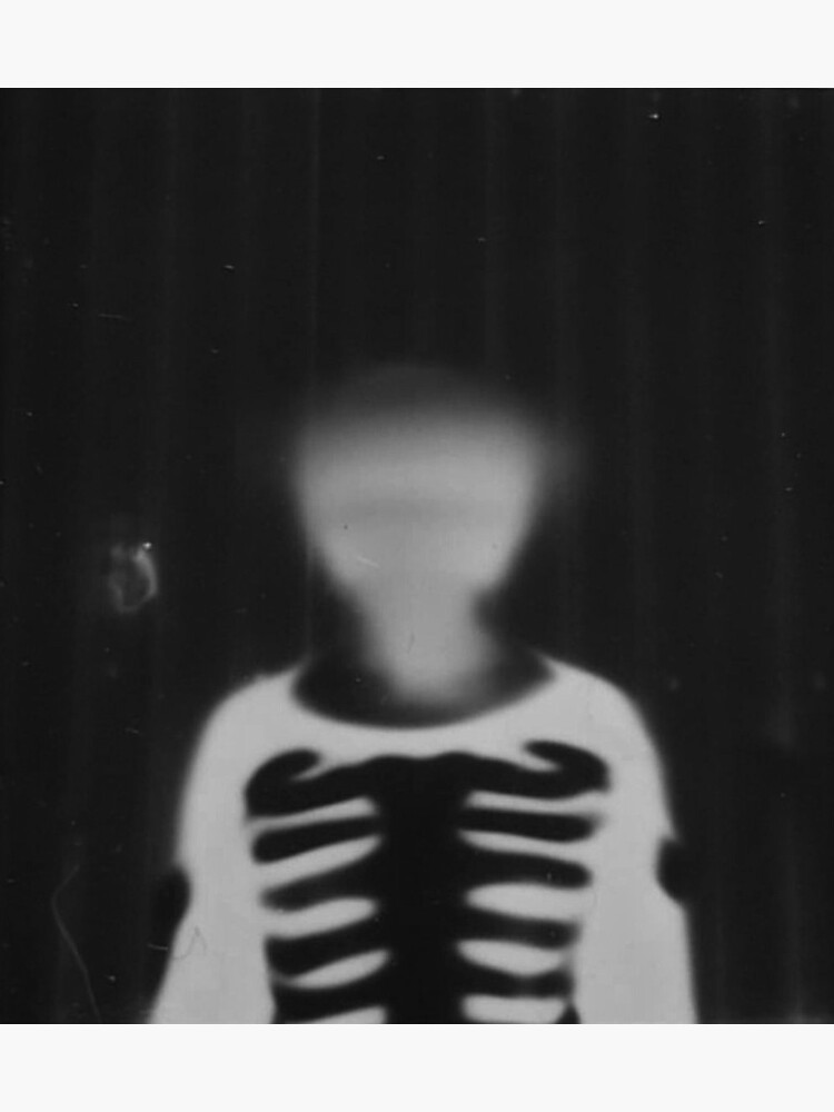 "Blurry Head Skeleton Pinhole Photo Negative (unedited version ...