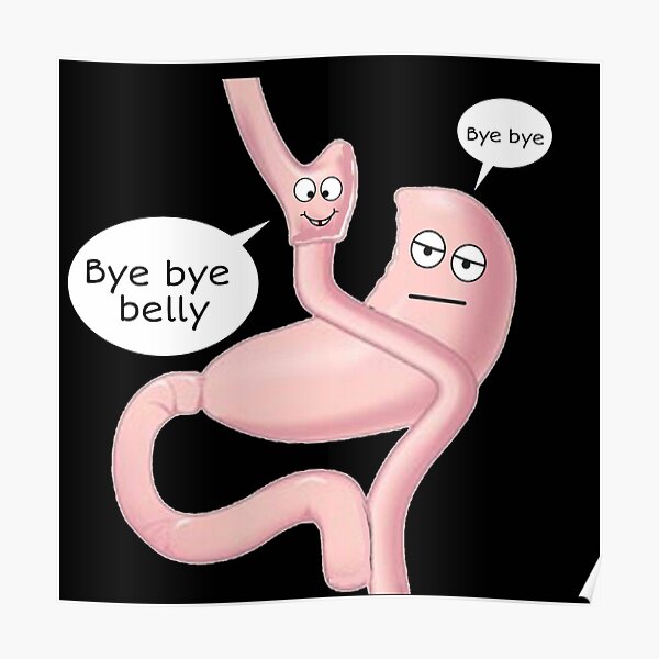 "Gastric Bypass - bye bye belly " Poster for Sale by Club287 | Redbubble