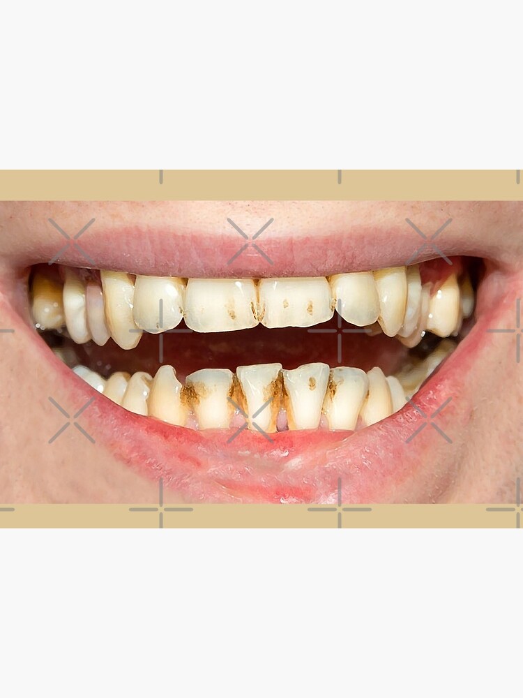 "Bad Teeth" Mask by AhmedFemo | Redbubble