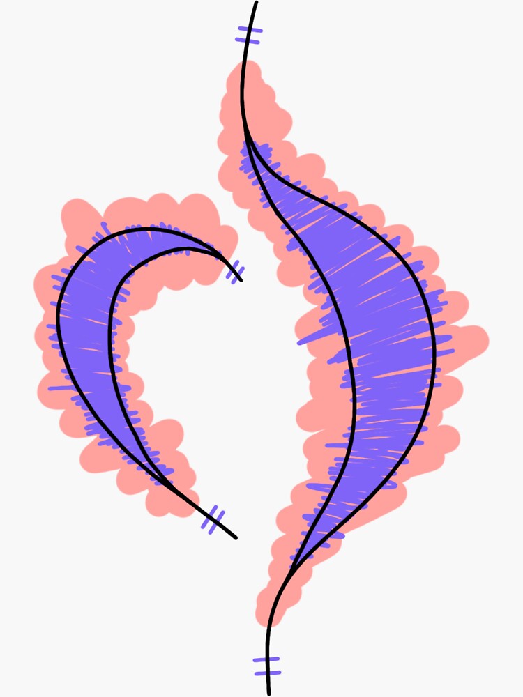 "Recovery Symbol" Sticker for Sale by Cassidyfelgner | Redbubble