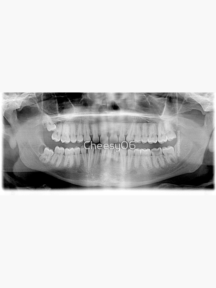 "X Ray smile" Sticker by Cheesy06 | Redbubble