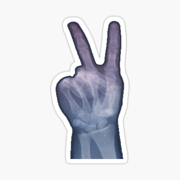 "X ray Peace Finger" Sticker by SUPERMED | Redbubble