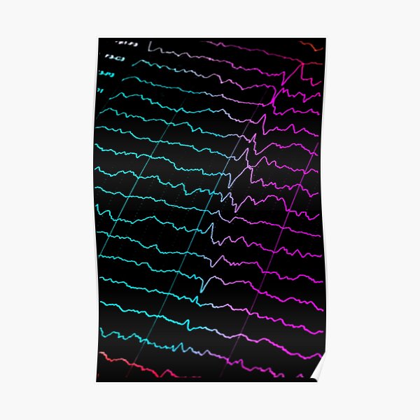 "EEG Epoch " Poster for Sale by Sleepygirl2010 | Redbubble