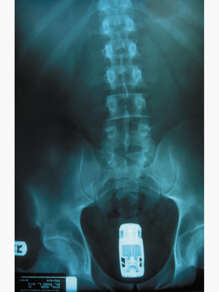 "jackass car" Sticker for Sale by avamango | Redbubble