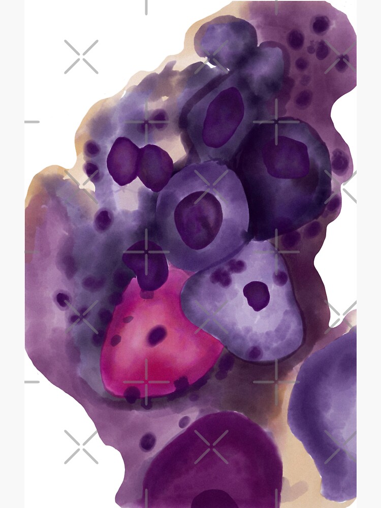 "Pap smear Art" Sticker for Sale by ArtyMed | Redbubble