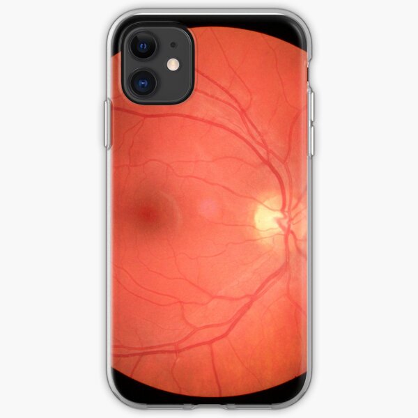 Optometry iPhone cases & covers | Redbubble